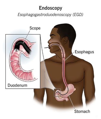 Endoscopy